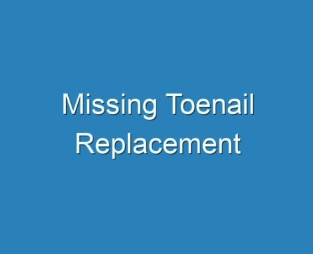 20+ Best Missing Toenail Replacement 2023 - Reviews